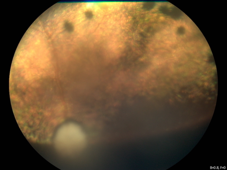 Vitrectomía en perros. Cirugía de desprendimiento de retina - IVO